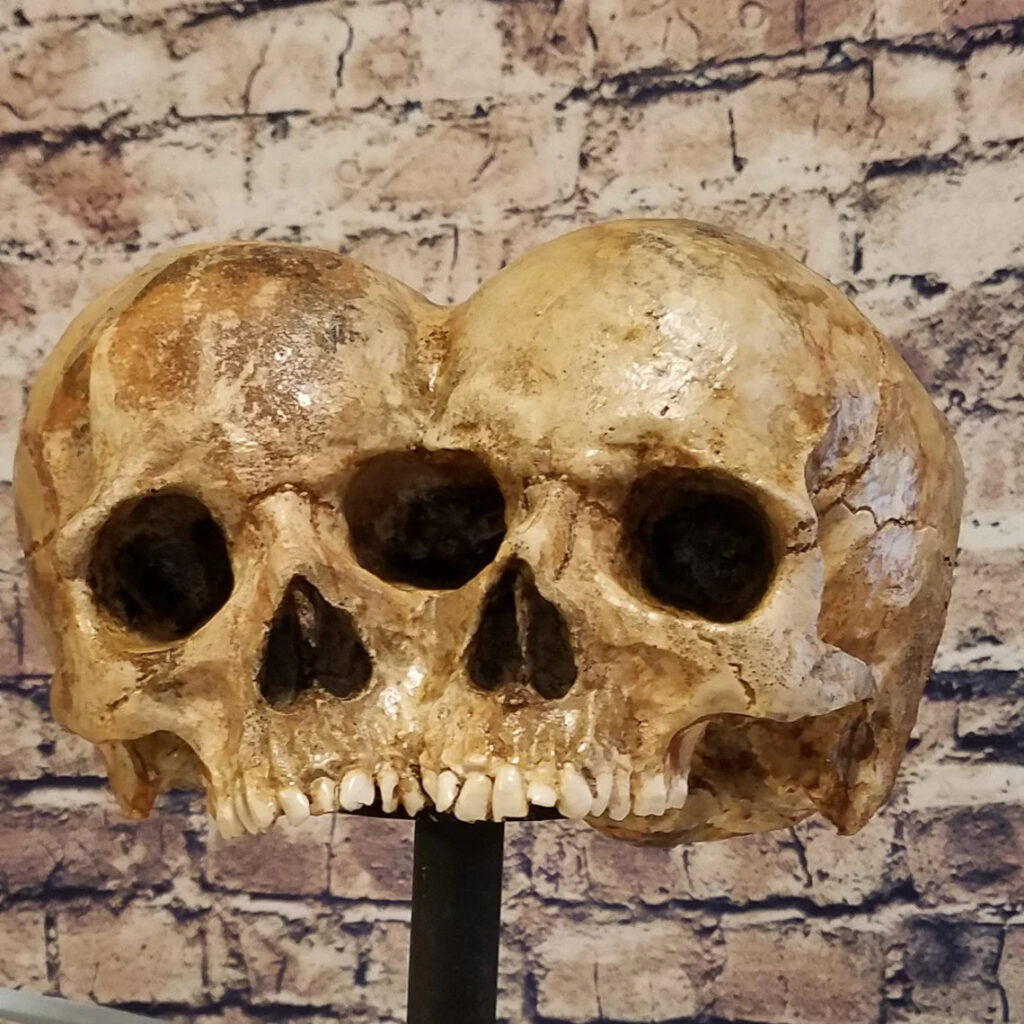 Conjoined Twins Human Skull Sculpture or Planter – NalaGila